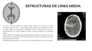 Neurorradiología Basica y Electro encefalograma digital | PPT