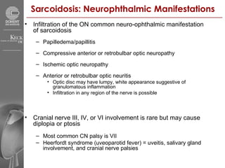 Neurosarcoidosis | PPT
