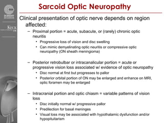 Neurosarcoidosis | PPT