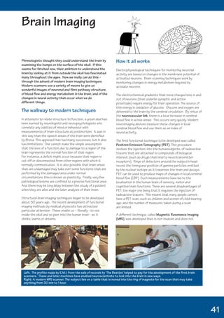 brain anatomy including brain stem cerebrum | PDF