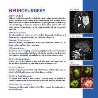 Neuroscience AIG Hospitals | PDF