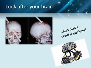 Neuroscience - Change management with the brain in mind | PDF