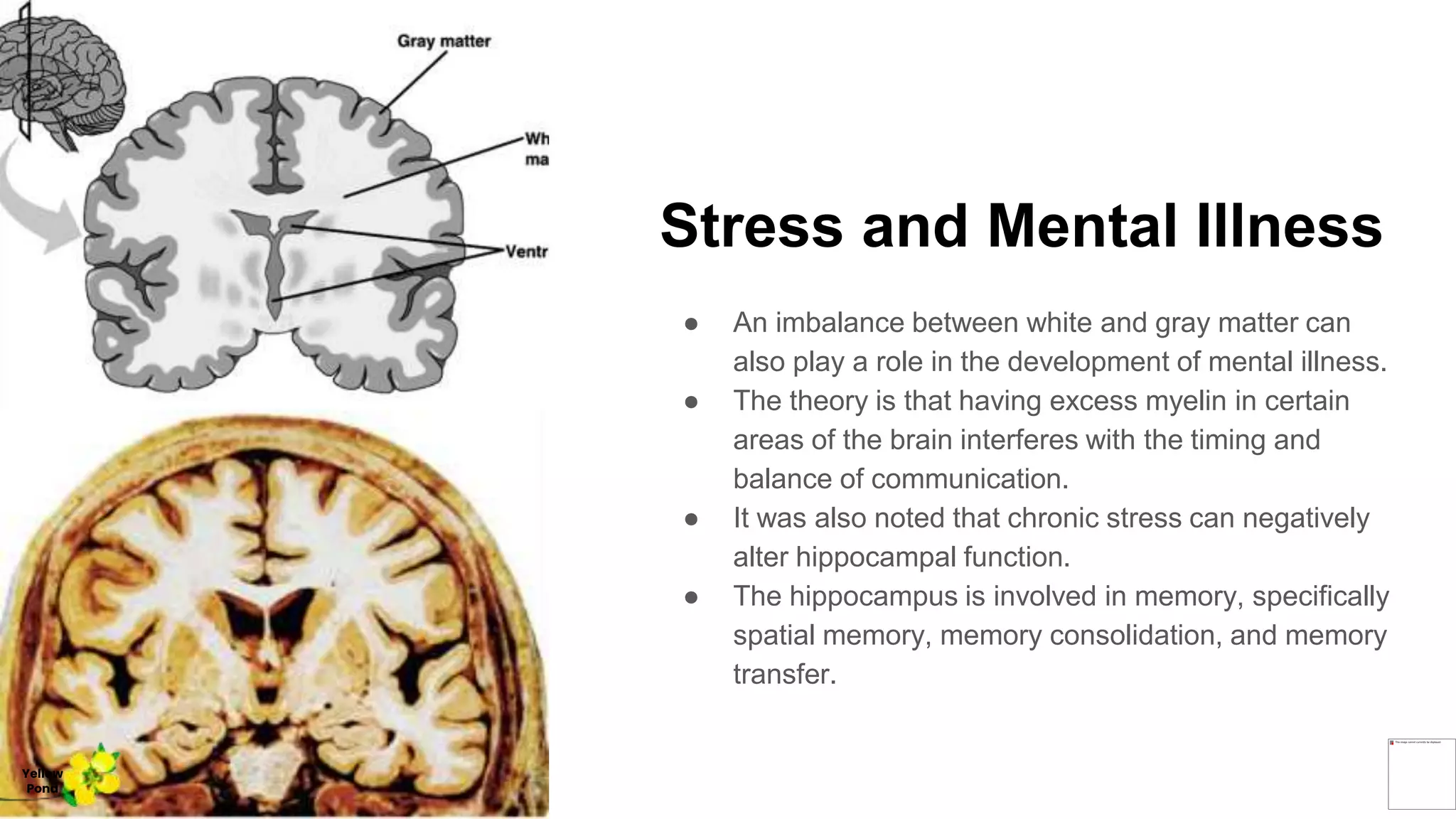 Neuroscience of Stress.pptx
