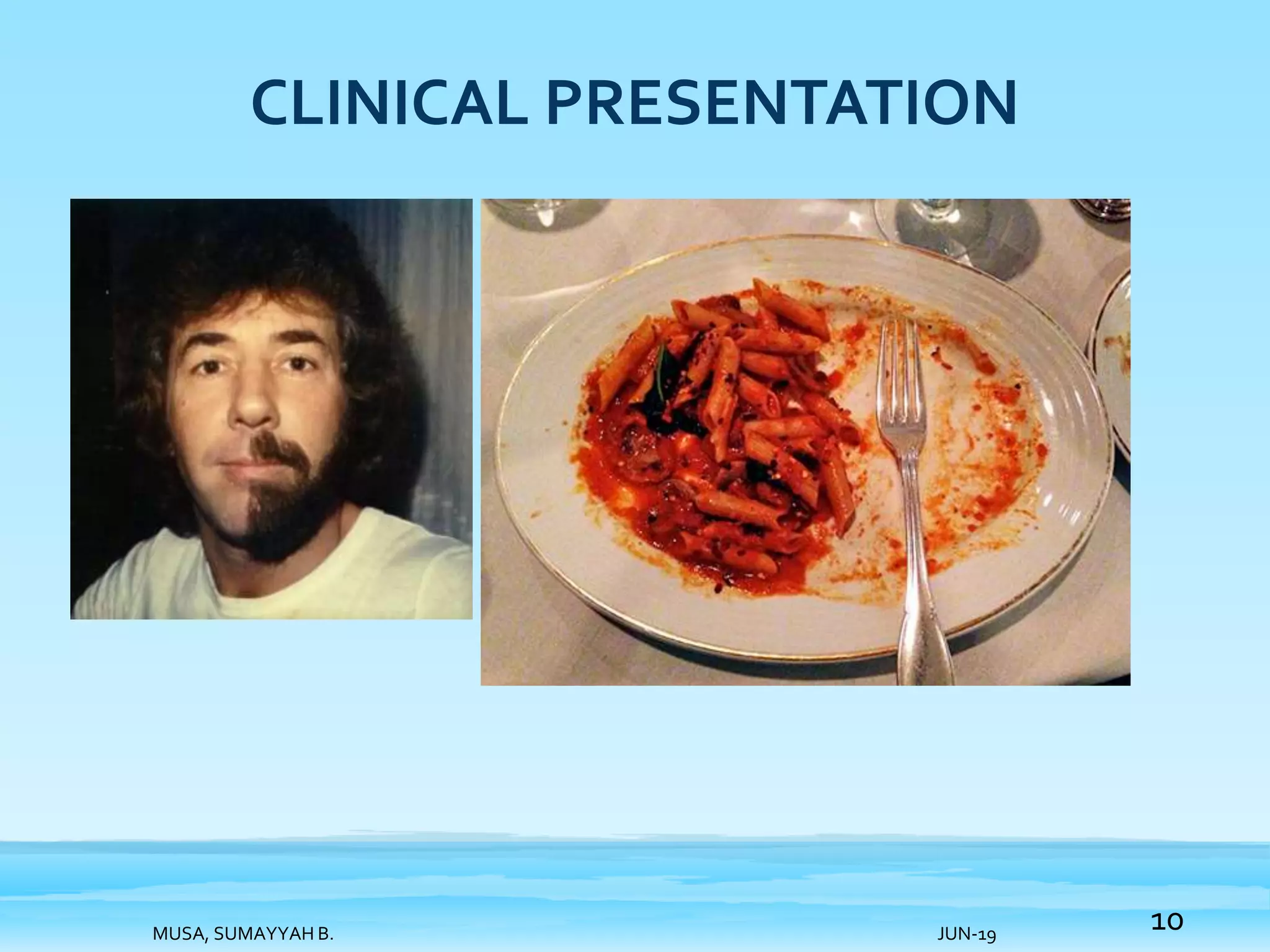 Post stroke hemispatial neglect syndrome | PPTX