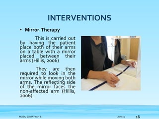Post stroke hemispatial neglect syndrome | PPTX