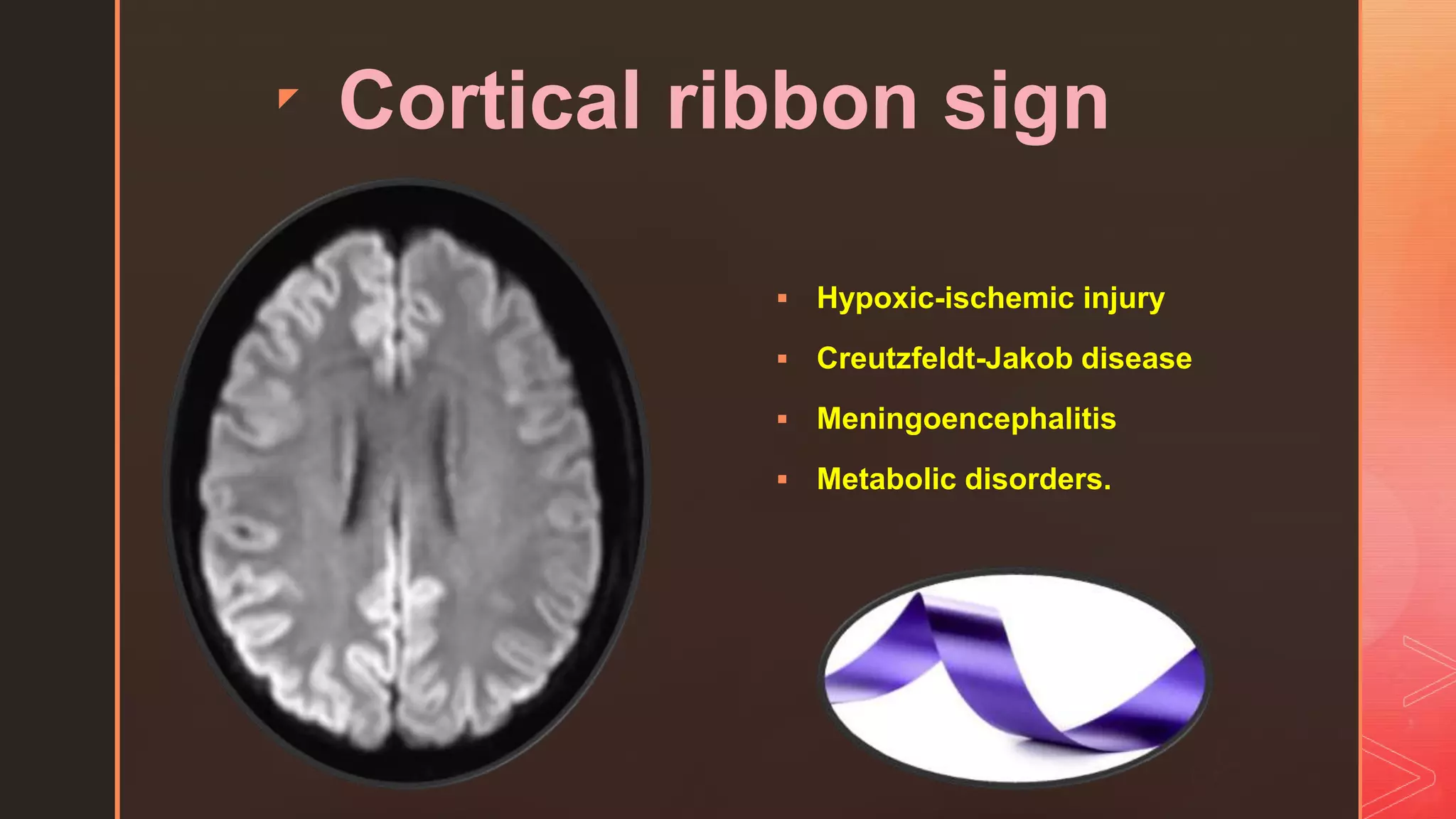 Neuro signs | PPTX