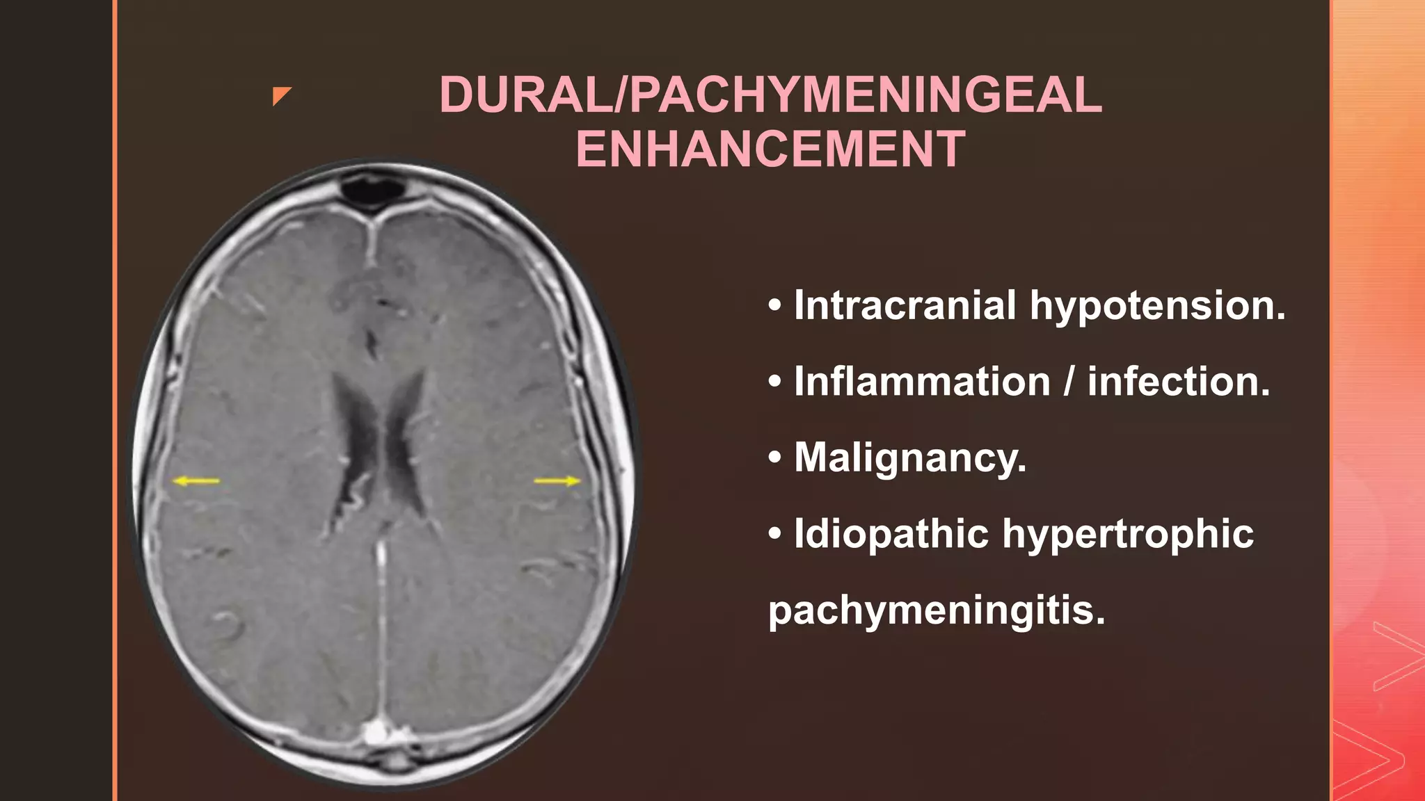 Neuro signs | PPTX