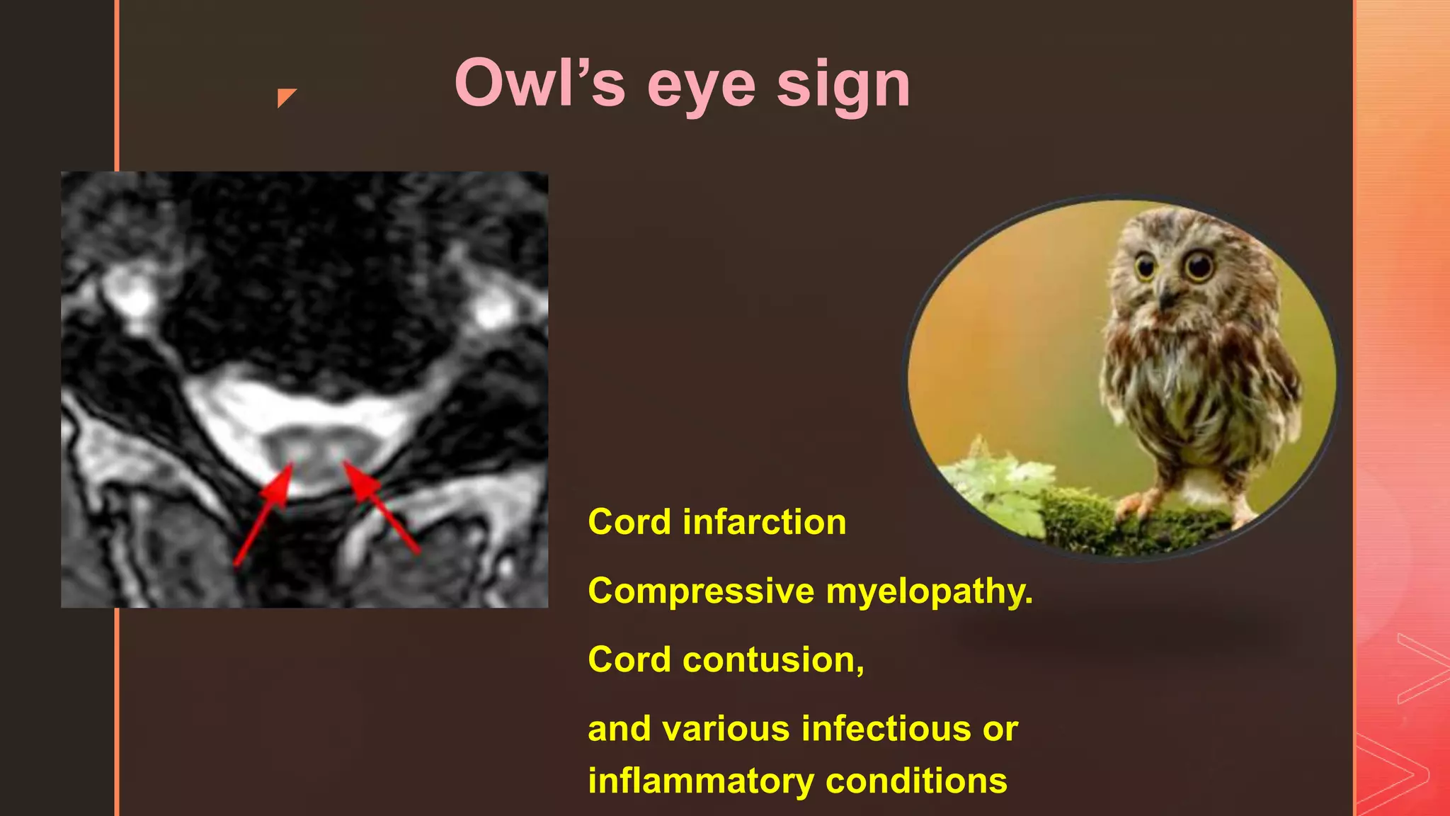 Neuro signs | PPTX