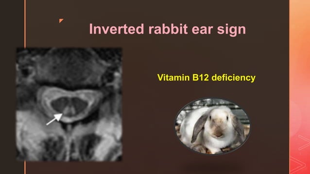 Neuro signs | PPTX | Brain and Nervous System Disorders | Diseases and ...