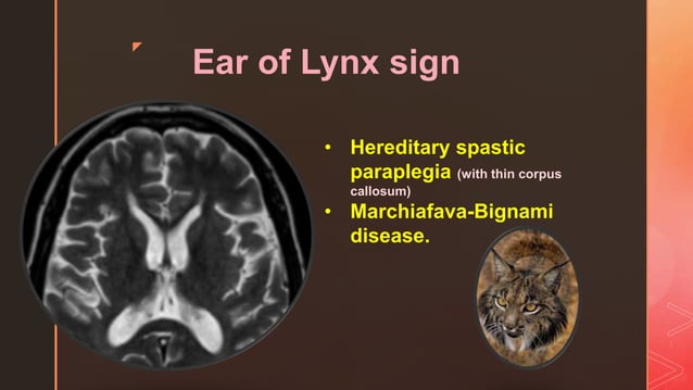 Neuro signs | PPTX | Brain and Nervous System Disorders | Diseases and ...