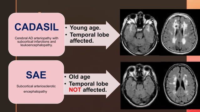 Neuro signs | PPTX | Brain and Nervous System Disorders | Diseases and ...