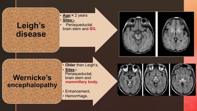 Neuro signs | PPTX | Brain and Nervous System Disorders | Diseases and ...