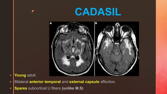 Neuro signs | PPTX | Brain and Nervous System Disorders | Diseases and ...