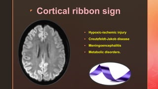 Neuro signs | PPT