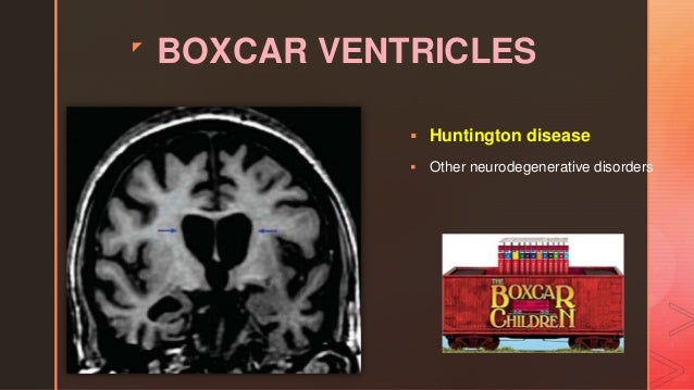Neuro signs