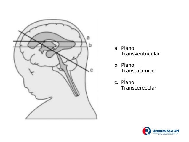 NEUROSONOGRAFIA FETAL