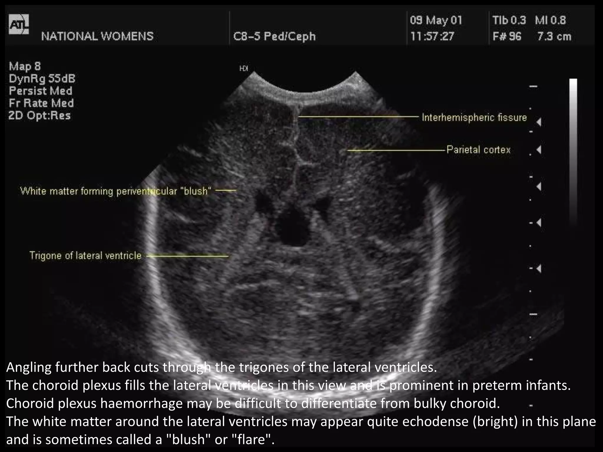 Neurosonogram.. Dr.Padmesh | PPTX