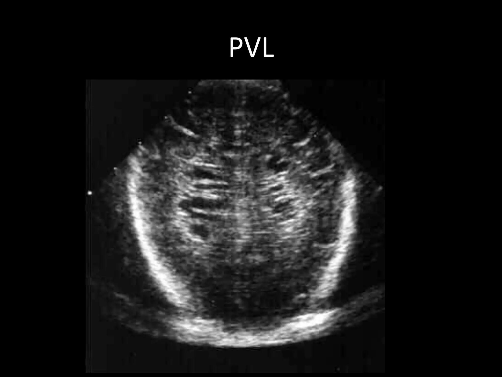 Neurosonogram.. Dr.Padmesh | PPTX