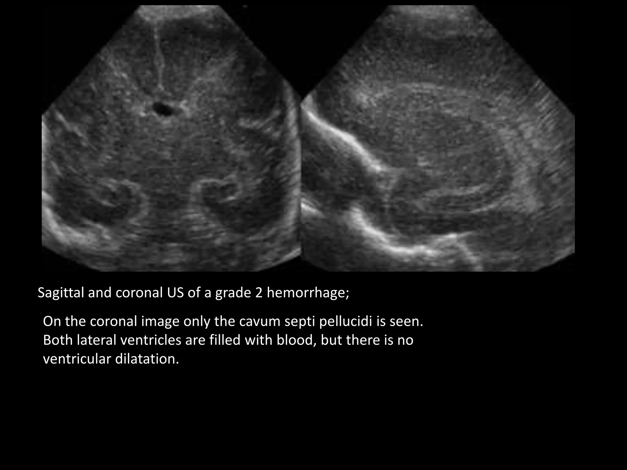 Neurosonogram.. Dr.Padmesh | PPTX