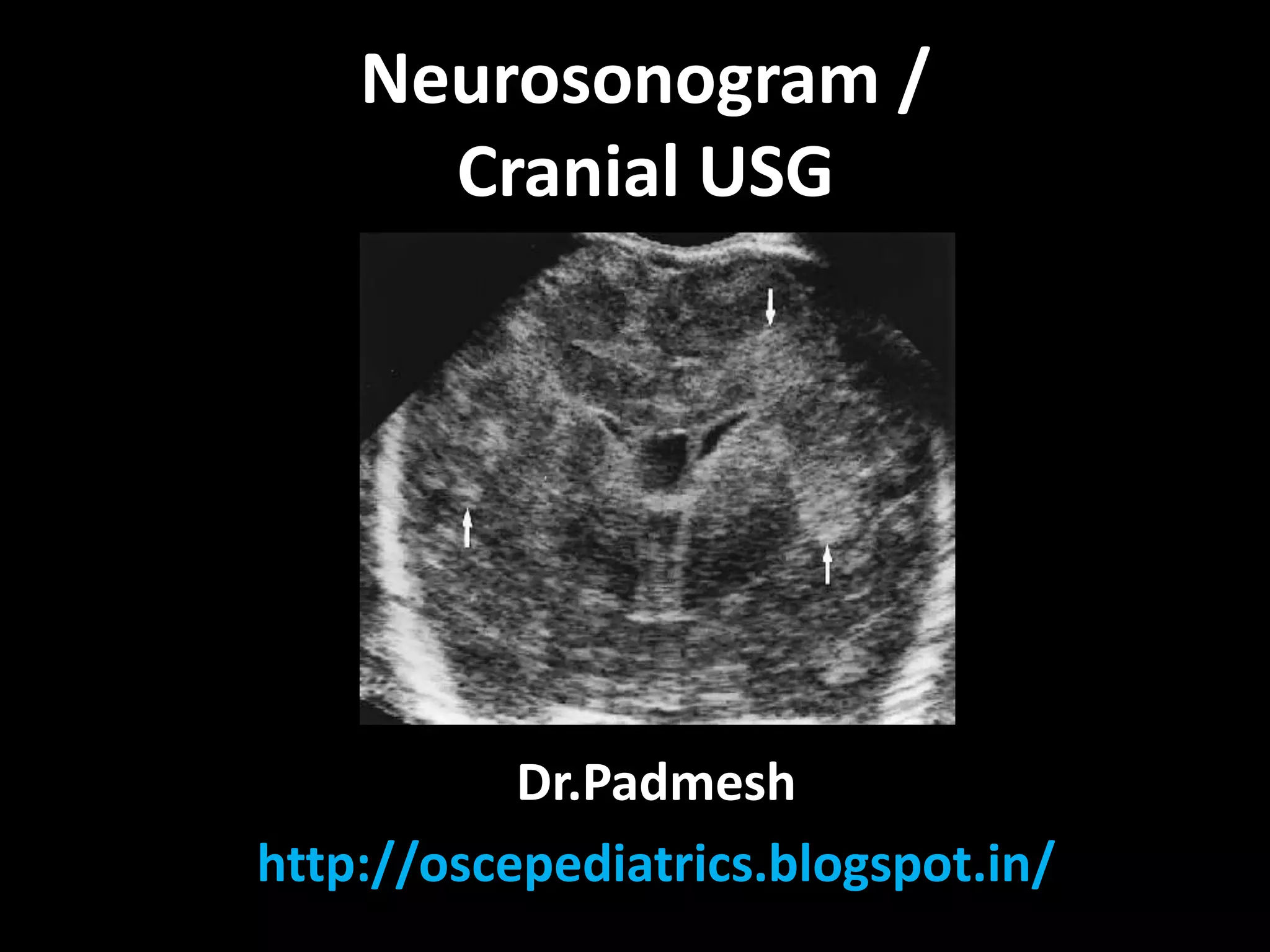 Neurosonogram.. Dr.Padmesh | PPT