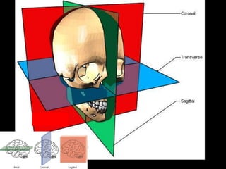 Neurosonogram.. Dr.Padmesh | PPTX
