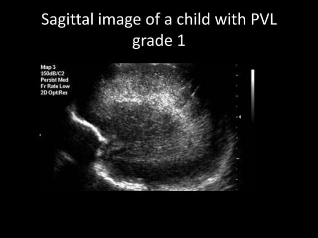 Neurosonogram.. Dr.Padmesh | PPTX