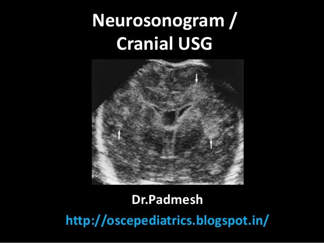 Neurosonogram.. Dr.Padmesh