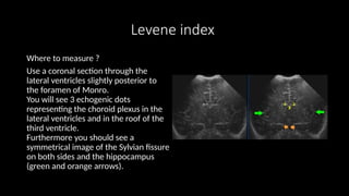 STANDARD PLANES IN NEUROSONOGRAM AND HOW TO AQUIRE THEM | PPTX