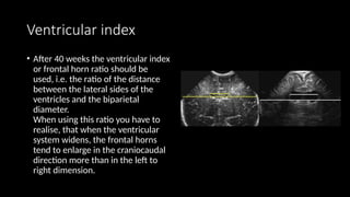 STANDARD PLANES IN NEUROSONOGRAM AND HOW TO AQUIRE THEM | PPTX