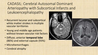 Neurospot | PPTX