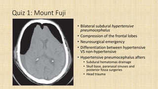 Neurospot | PPTX