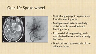 Neurospot | PPTX | Blood Disorders | Diseases and Conditions
