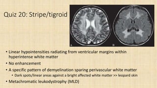 Neurospot | PPTX | Blood Disorders | Diseases and Conditions