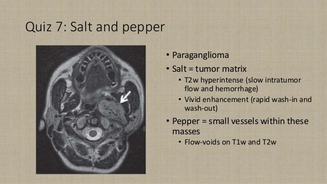Neurospot