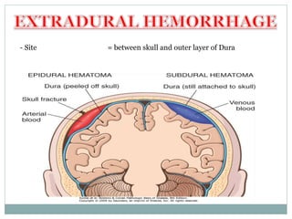 Neurosurgery | PPTX