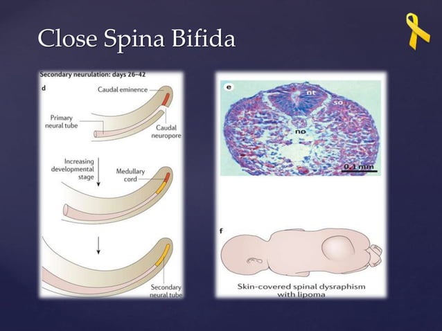Developmental Anomalies of Skull and Spine | PPT