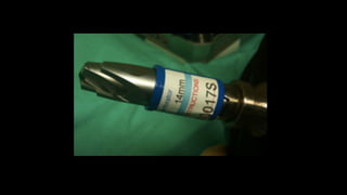 Wilson: Neurosurgery for Everyone | PDF