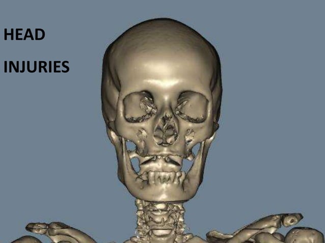 Neurosurgery revision | PPT