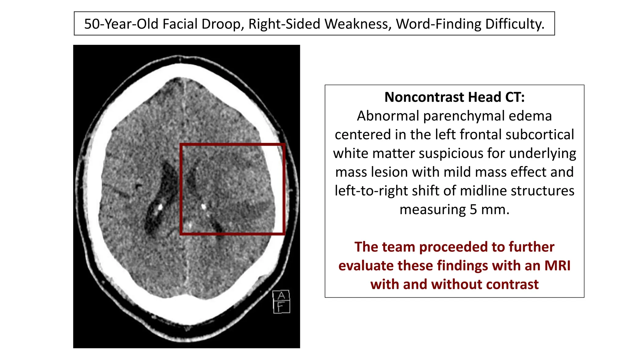 Neurosurgical Intracranial Infections - FINAL 10-17-23.pptx