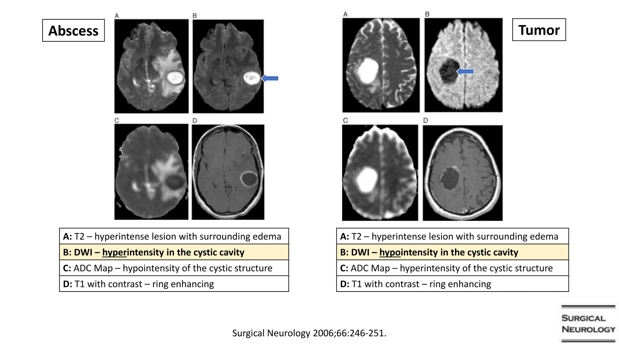 Neurosurgical Intracranial Infections - FINAL 10-17-23.pptx