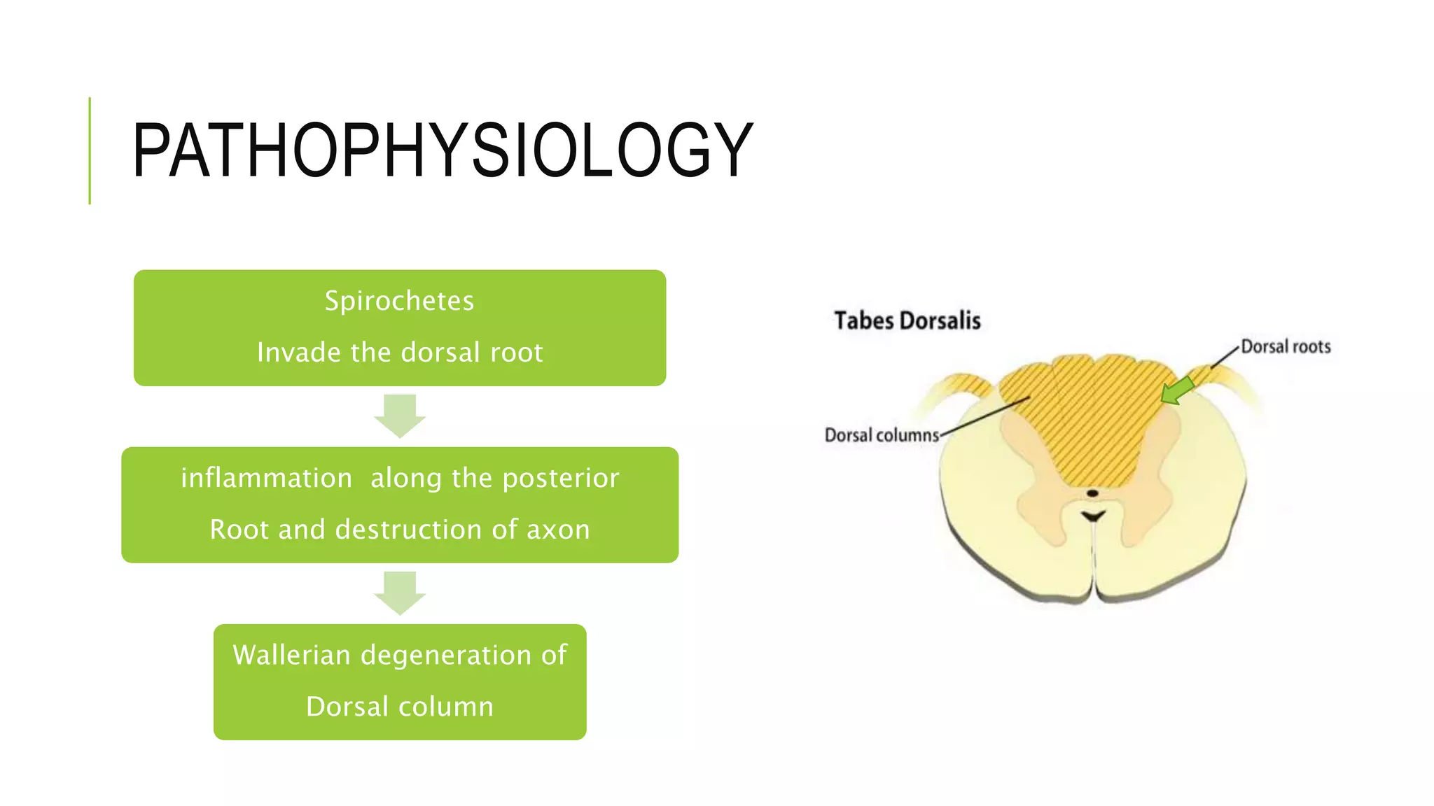 Neurosyphilis | PPTX