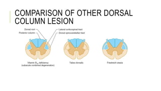 Neurosyphilis | PPTX