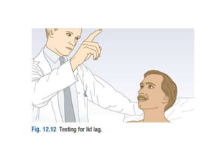 neuro test.pptx