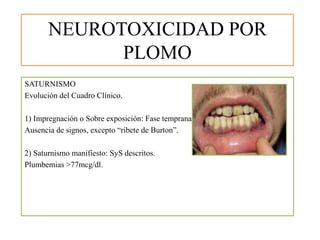 Neurotoxicidad por plomo y arsénico | PDF | Medical Health