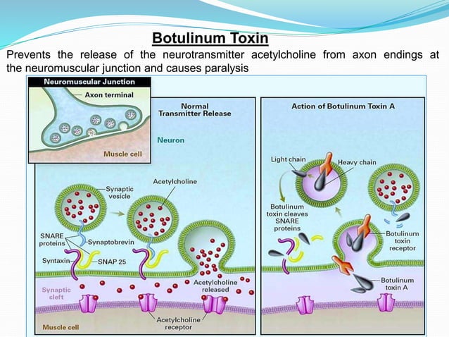 Neurotoxicity and its evaluation | PPTX | Brain and Nervous System ...