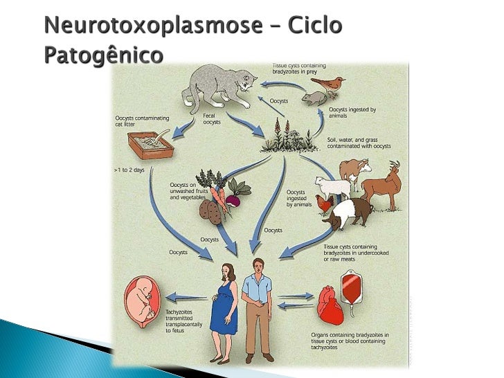 Neurotoxoplasmose
