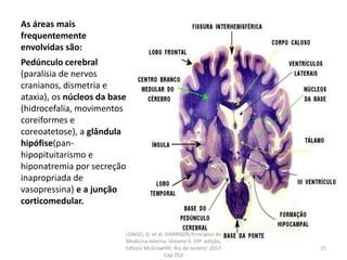 Neuro Toxoplasmose | PPTX