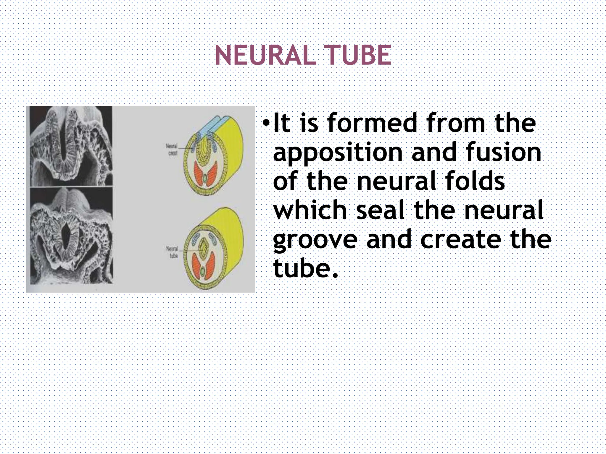 KCMC Surgical NEUROTUBE DEFECTS_101932.ppt
