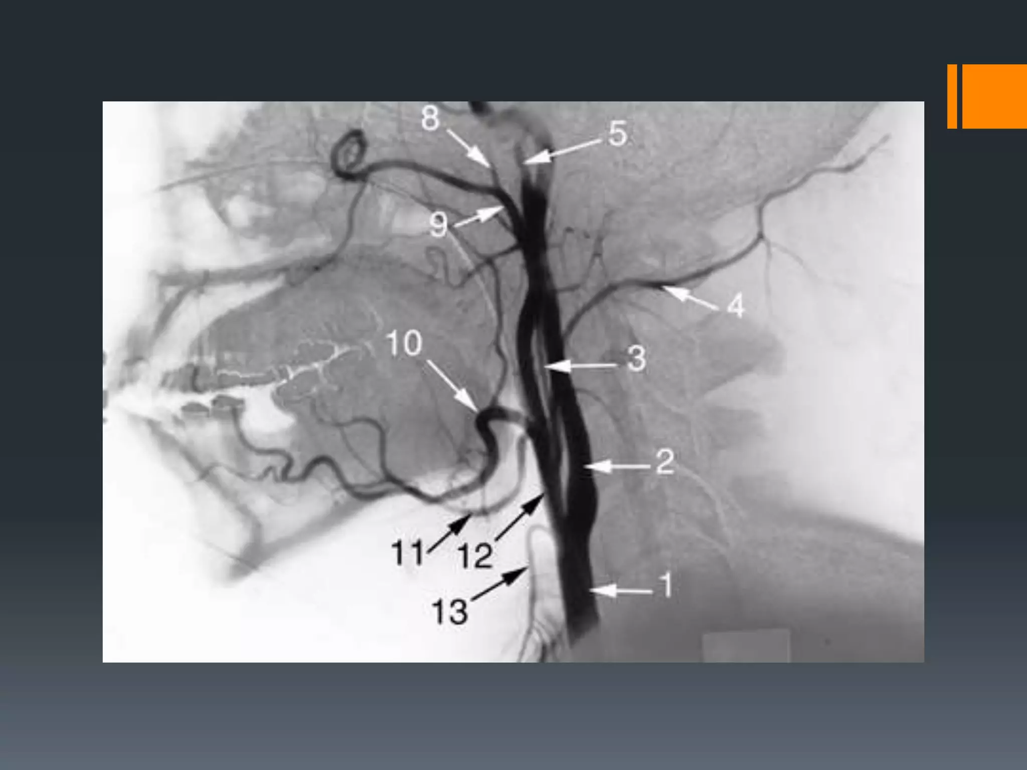 Neurovascular anatomy | PPTX
