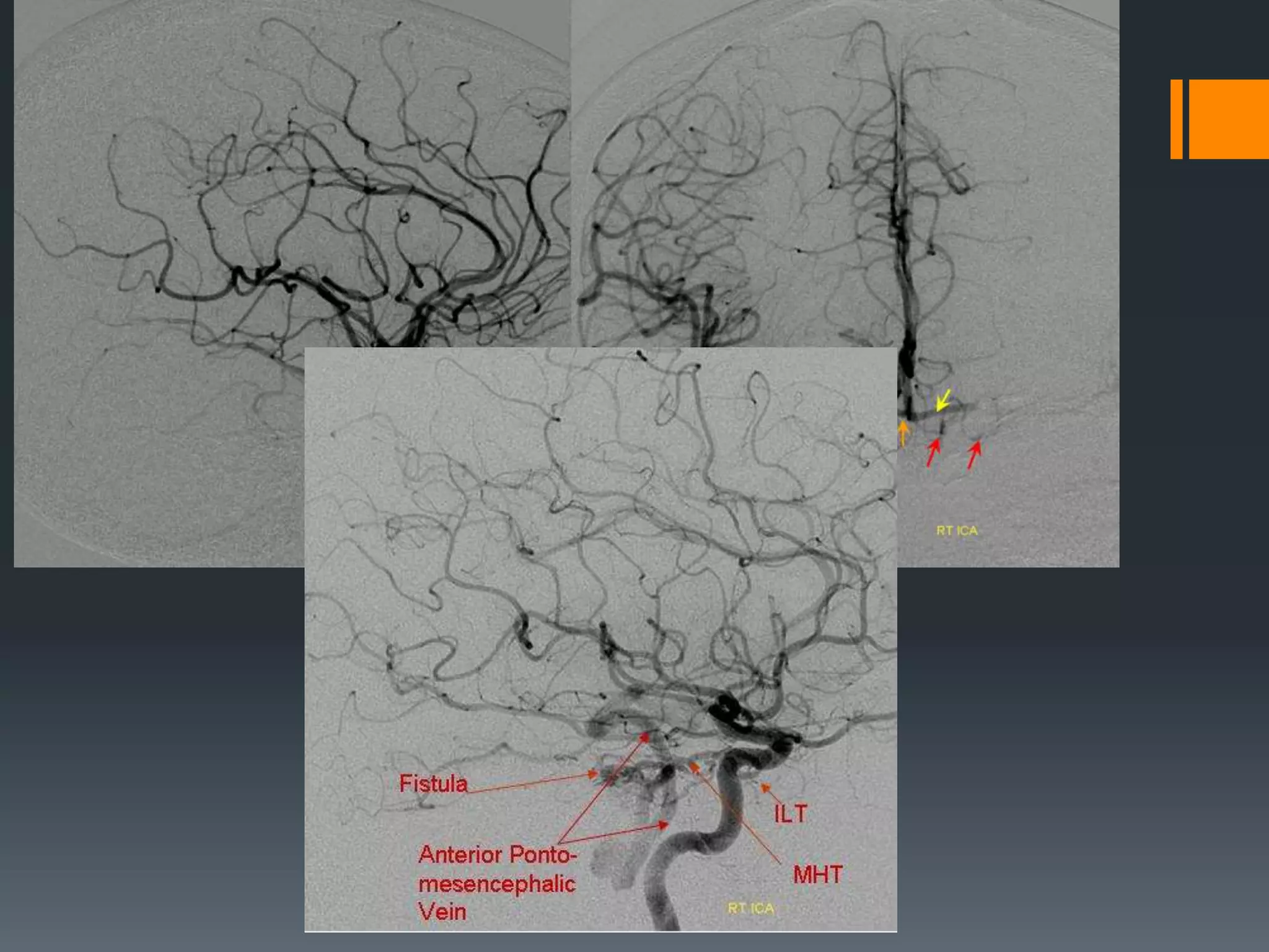 Neurovascular anatomy | PPTX